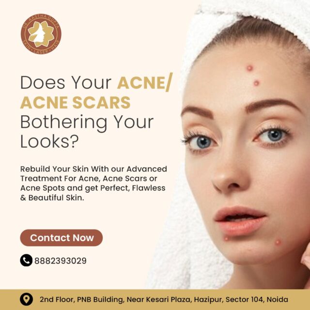 Home 1 - Dr. Aastha Gupta Skin Clinic